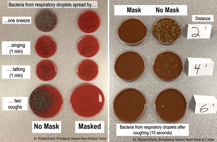 Microbiologist Does Simple Demo to Show How Face Masks Are Effective ...